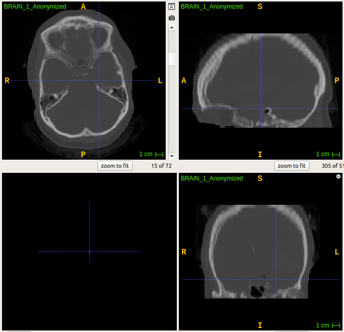 Basics for CT Medical Imaging (Python) | by Vaibhav Bahel | Analytics ...
