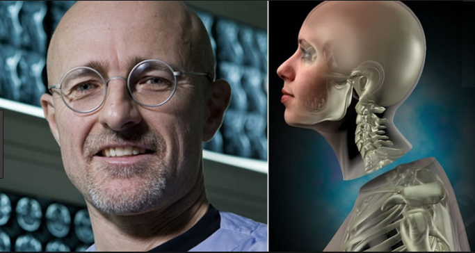 World’s first human head transplant to take place in 8 months | by John ...