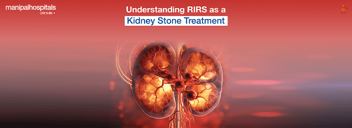 What is RIRS? Is It a Reliable Kidney Stone Laser Surgery? | by Manipal Hospitals | Jan, 2024 ...