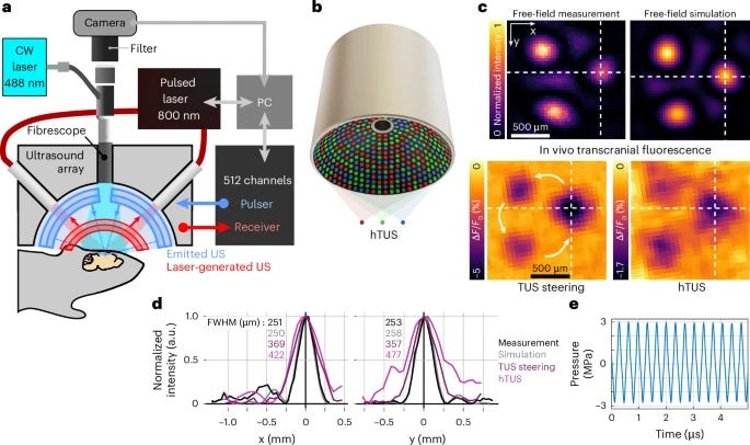 Why Holographic Ultrasound Changes Everything We Thought About Brain ...