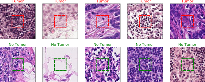 Convolutional Neural Network for Detecting Cancer Tumors in Microscopic ...