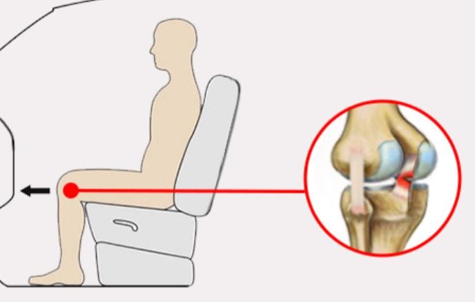 PCL Injury - Dr Shekhar Srivastav | Delhi Arthroscopy - Medium