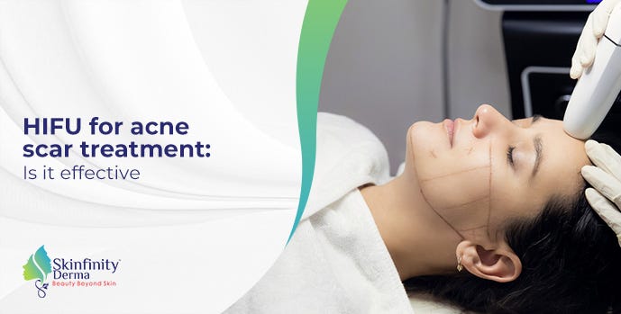 HIFU for acne scar treatment: Is it effective? | by Skinfinity Derma ...