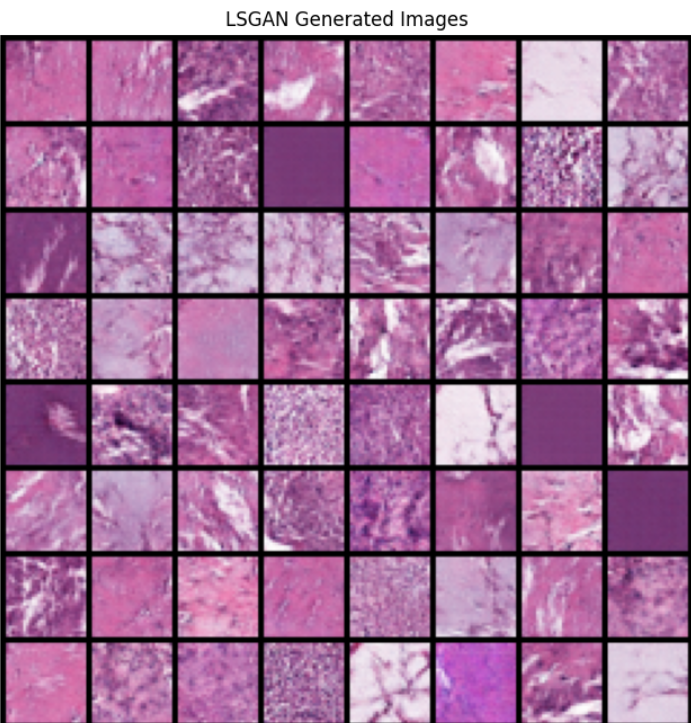 Battle of GANs: LSGAN vs WGAN vs WGAN-GP on Histopathology Images | by Vinit Samani | Medium
