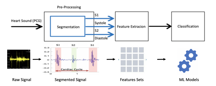 Brief Review — A New Method For Heart Disease Detection Long Short Term Feature Extraction From