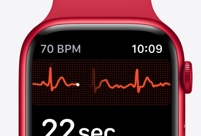 Apple’s ECG Feature. The future of healthcare is on your… | by Travis ...