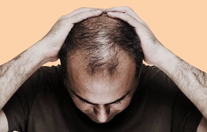 What are the causes of hair fall and how to prevent it? | by Er ...