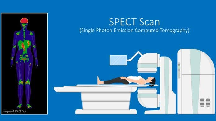 SPECT (Single Photon Emission Computed Tomography) Scan | by Gaurav Durge | Medium