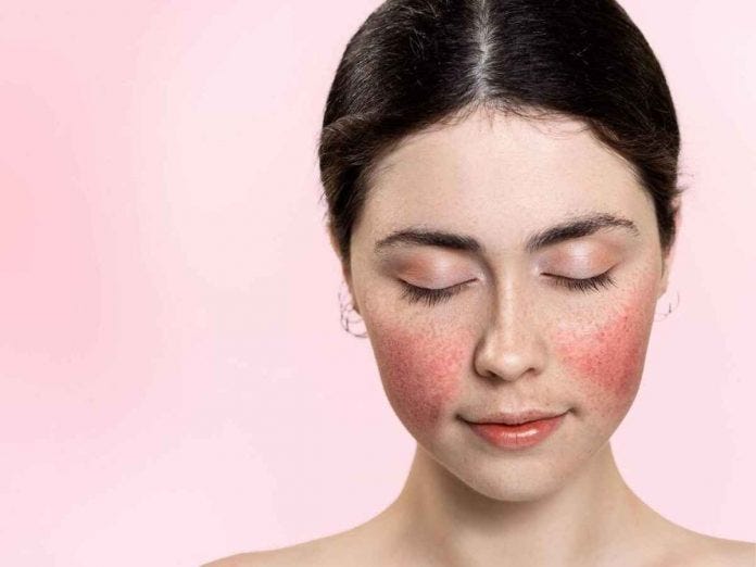 How To Reduce Redness, Irritation, and Inflammation | by Ayazinfortech ...