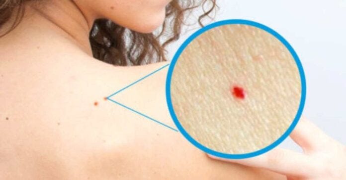 Do you have red dots on skin? Then you should be worried! | Medium