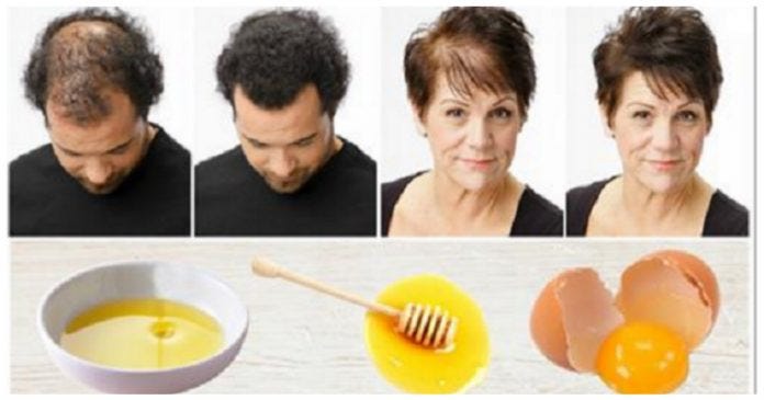 The Magic Recipe For Fastest Hair Growth! 3 Ingredients Only! | by ...