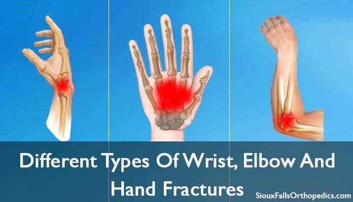 Types of Wrist, Hand and Elbow Fractures | by Sioux Fall Orthopedics ...