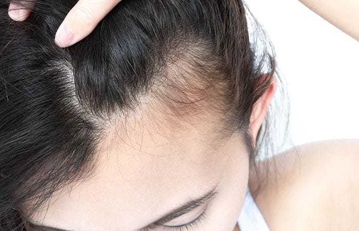 HOW TO RECOGNISE THE SIGNS OF NEW HAIR GROWTH | by Faiz Akram | Medium