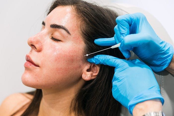 Targeted Areas for PDO Thread Applications | by London Beauty Spot ...