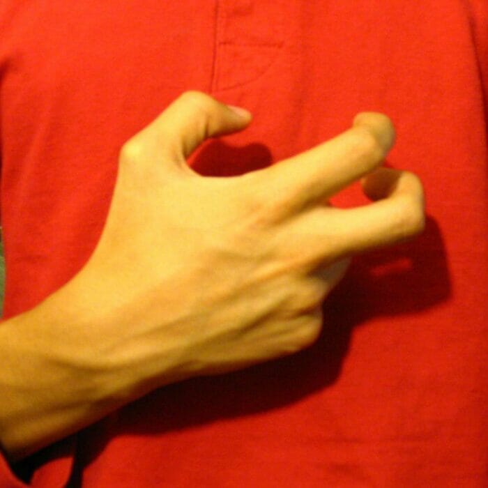 Recognizing Malocchio Symptoms: A Guide | by Symptom Finder | Jun, 2023 ...