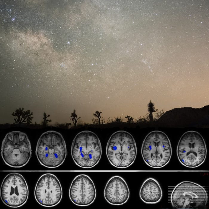 How My Brain Injury Sent Me Back in Time | by Jessica Minier | Deep ...