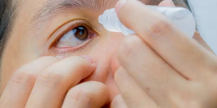 Overcoming Pink Eye: Effective Treatment Strategies | by Henry Zen ...