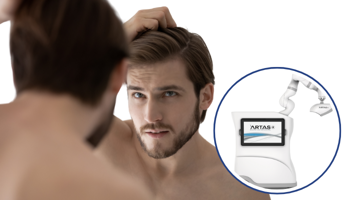 Why ARTAS Robotic Hair Restoration Leads the Way in Hair Transplant ...