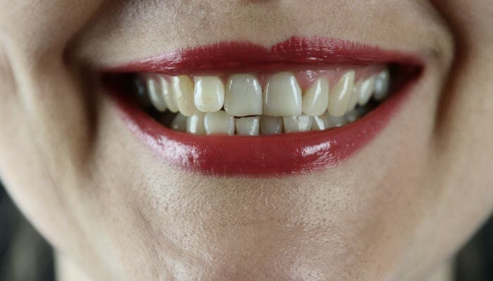 How to Deal With Crooked Teeth & Misaligned Bites | by Dental Group of ...