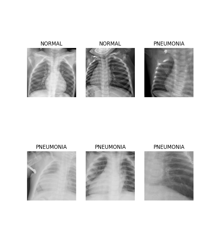 xray-pneumonia-detection with FastAi python | by Arasaltan | May, 2025 ...