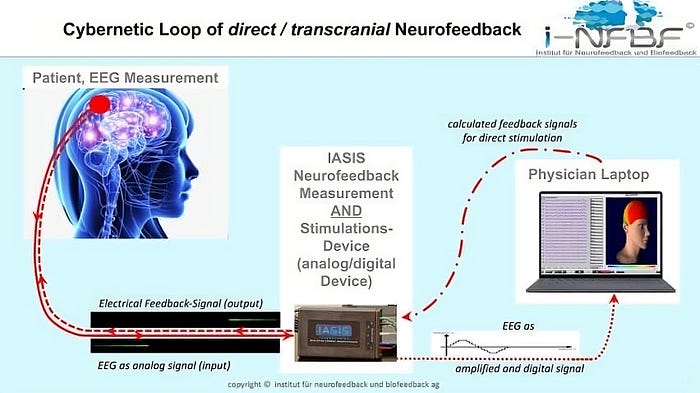 How MicroCurrent Neurofeedback (MCN) Can Heal and Reprogram The Brain