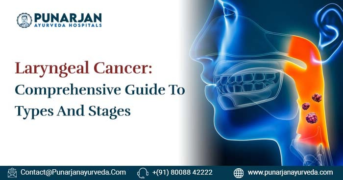 Laryngeal Cancer: Comprehensive Guide To Types And Stages - Raghu Punarjan - Medium