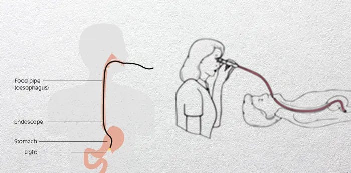 Colon Endoscopy Doctor In Ahmedabad | Laparoscopic Colon Surgery ...