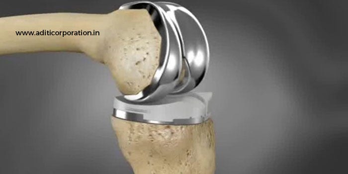 Which Materials Can Be Used For Knee Replacement Implants? | by Aditi ...