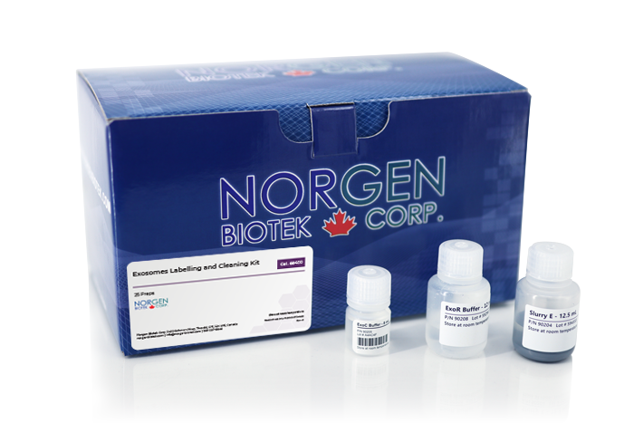 Exosome Kits: Streamlining Extracellular Vesicle Isolation with Denovo ...