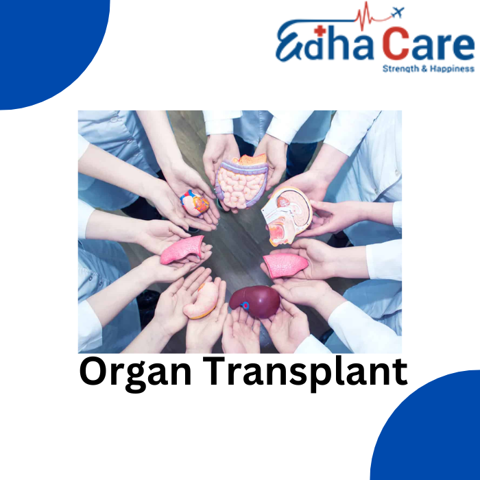 Best Organ Transplant Surgery In India | EdhaCare | by shaym kumar | Medium