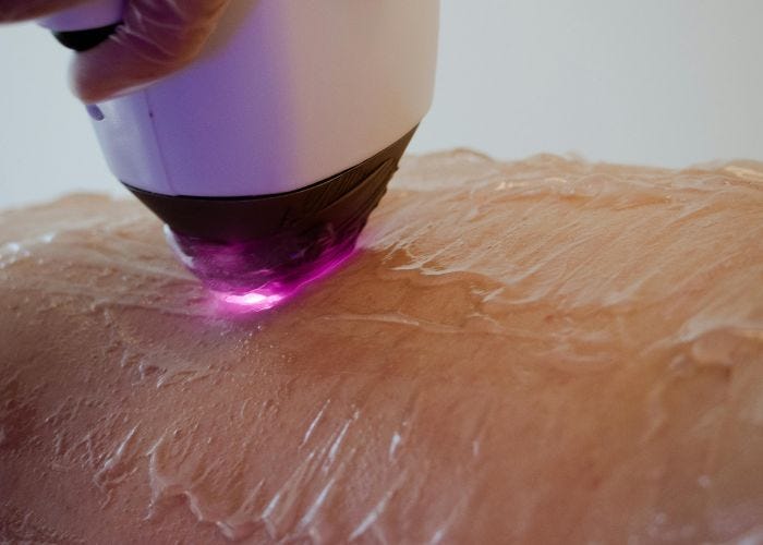 Navigating Post-Laser Hair Removal Care: What to Do and What to Avoid