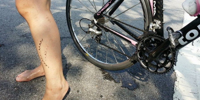 “My Bike’s OK..” — The True Indication That the Cyclist Is Ok After a ...
