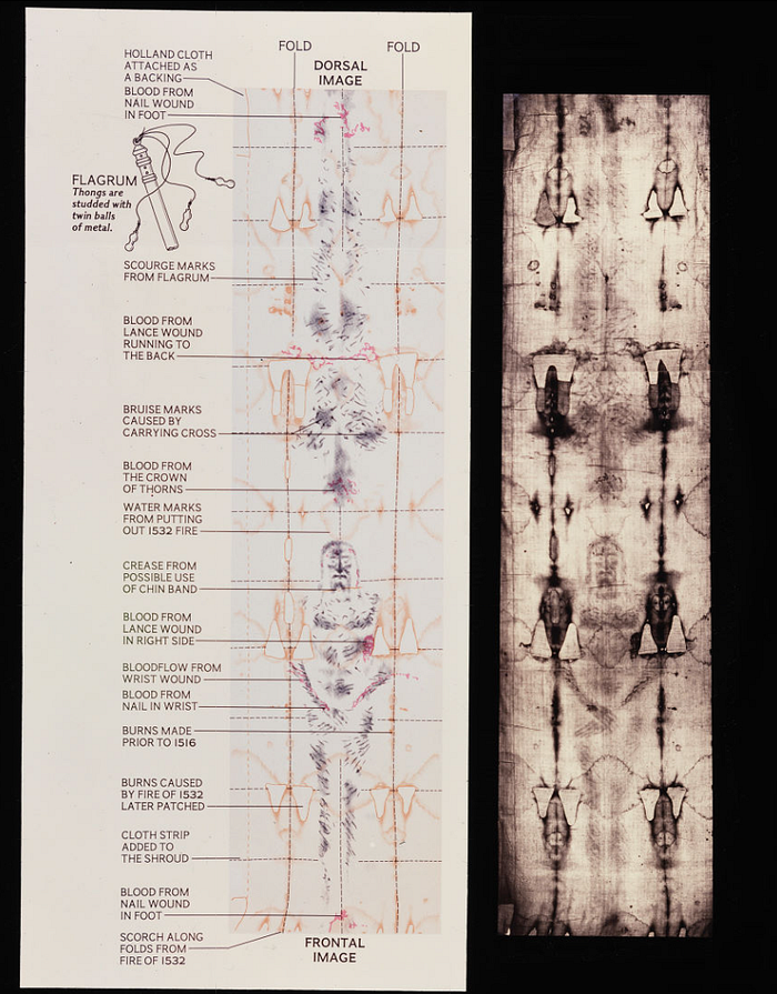 The Holy Shroud Of Turin Is The Image Of Jesus Christ, The Man-God