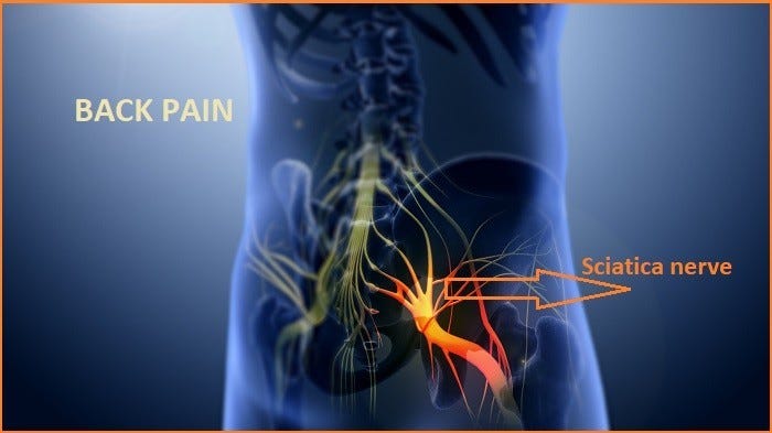 Strange Stretch fixes back pain FAST | by Waytomaintainhealth | Medium