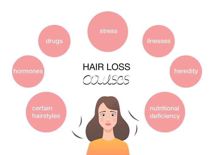 What are the common causes of hair fall? | by Dr Neha Agrawal (ECOS ...