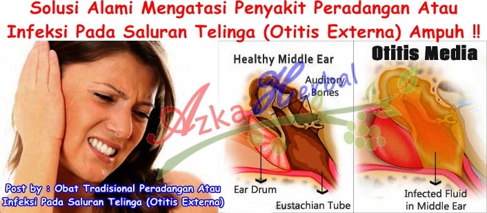 Obat Tradisional Peradangan Atau Infeksi Pada Saluran Telinga (Otitis ...