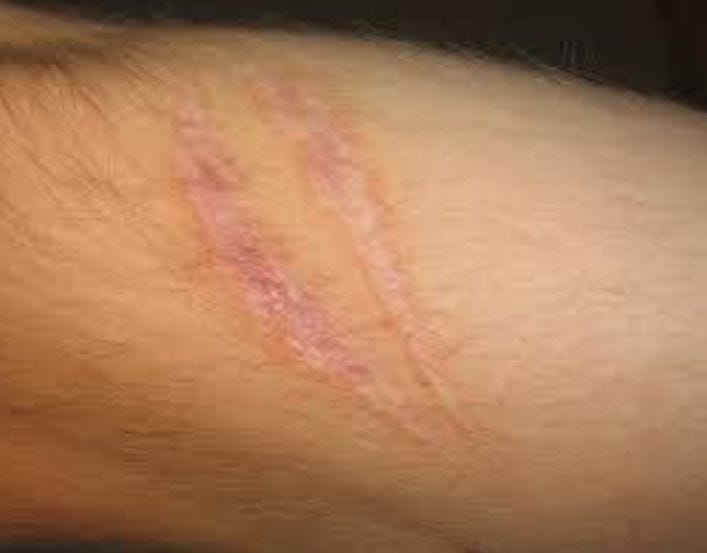 THE SCAR!!! Stories of strength and victories | by Fadekefelicia | Nov ...