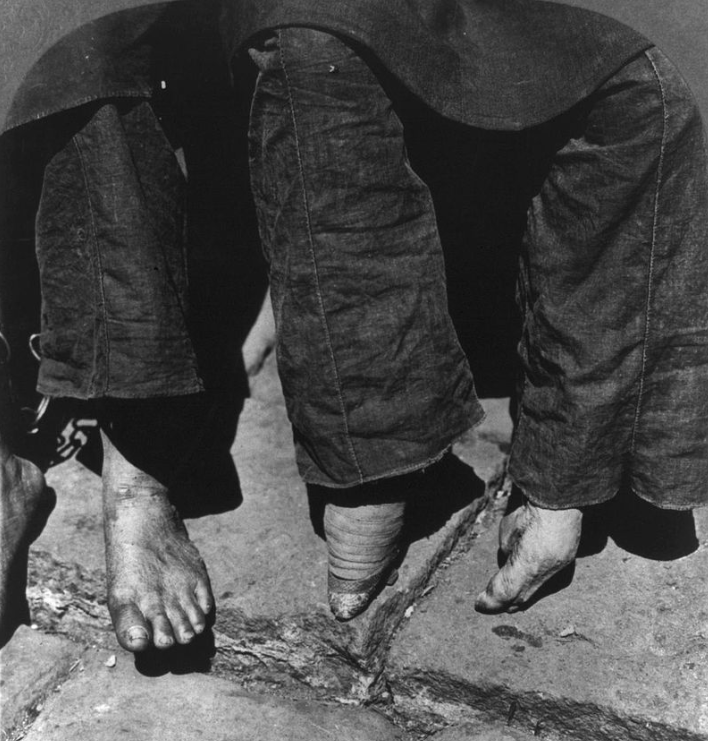 4 Deadliest Fashion Trends From History | by Beyond Truth | Lessons ...