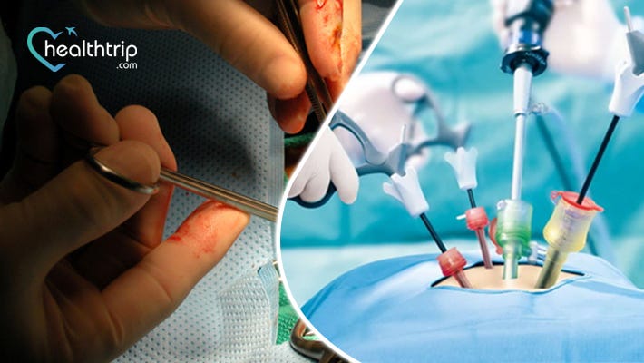 Laparoscopic Surgery vs. Open Surgery: Which is Right for You? | by ...