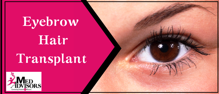 Eyebrow Hair Transplant | Eyebrow Restoration | by medadvisors | Medium