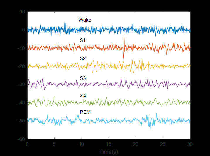 Classification Of Sleep Stages Via Machine Learning Algorithms By Ali