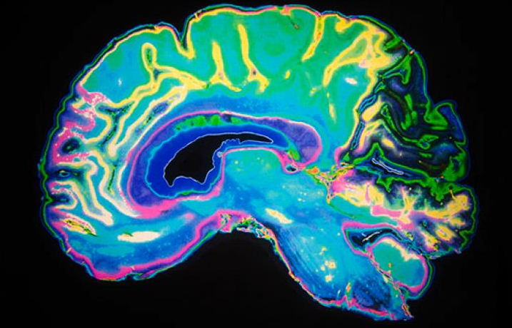 How to Get Everything Done Through Dopamine Chains | by Dan ...