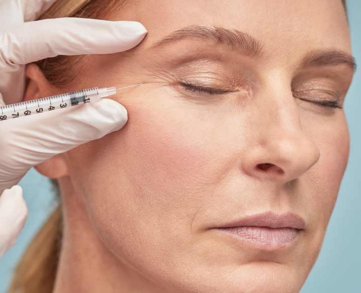 A Short Guide to Vampire Facial. The non-surgical vampire facial is a ...