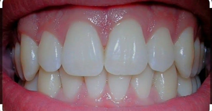 TEETH FOR THOUGHT. I was picking out the mango hairs from… | by Léna ...