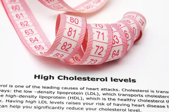 Top 7 Unusual Signs of High Cholesterol in Women Over 50 | by Faizan ...