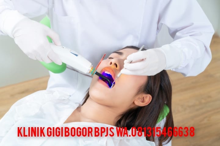 Klinik gigi bogor BPJS wa 0813–1546–6638 - Gigi Klinik - Medium