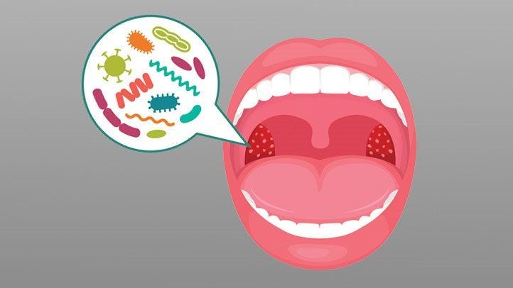Strep Throat (Streptococcal Pharyngitis) | by Vaishali Sharma | Medium
