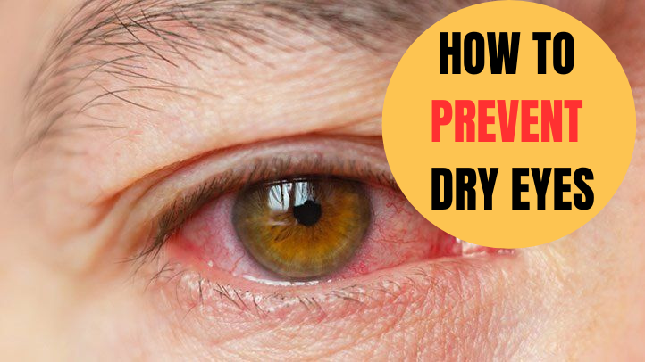 Tips to prevent dry eyes. Understand your vision health: Tips to… | by ...