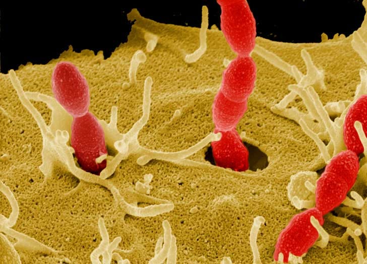 A microorganism is a living entity that is so small it can only be seen ...