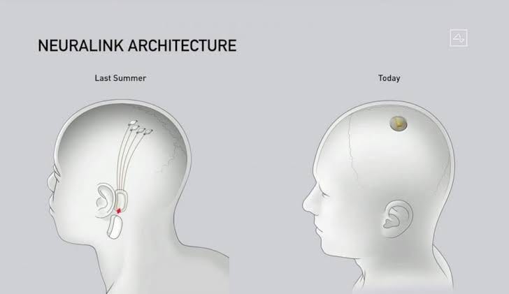Breaking Ground Elon Musk Reveals Successful Implantation Of Neuralink